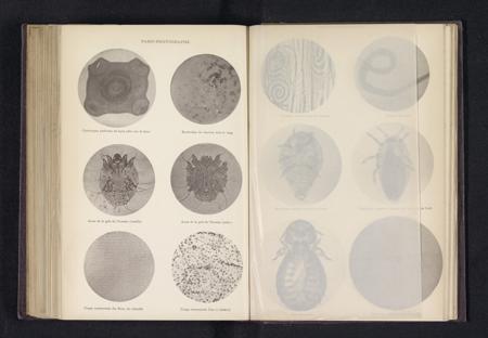 Scabies Definition, Meaning & Usage | FineDictionary.com