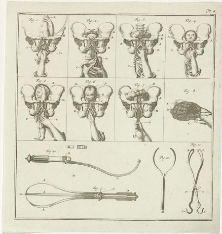 Gynecology Definition, Meaning & Usage | FineDictionary.com