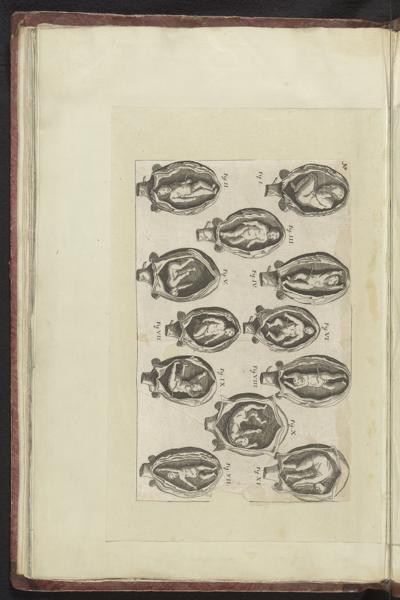 Fetus Definition, Meaning & Usage | FineDictionary.com